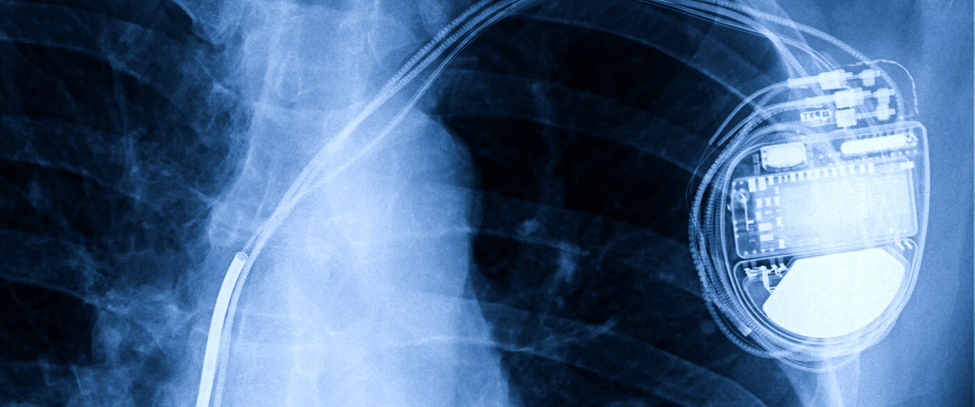 Active Implantable Medical Devices | BSI Active Implantable Medical Devices | BSI